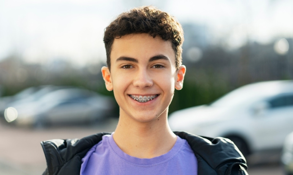 Wondering How Long Braces Take? Here’s the Real Answer